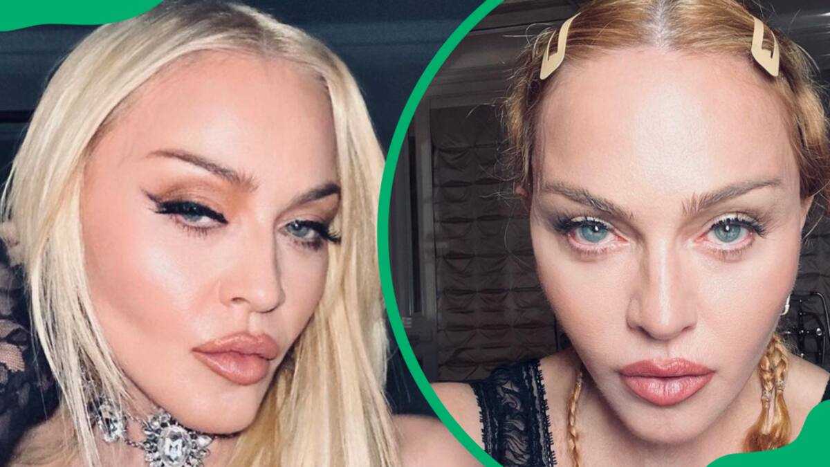 Madonna's plastic surgery: Timeline, experts' analysis, and photos ...