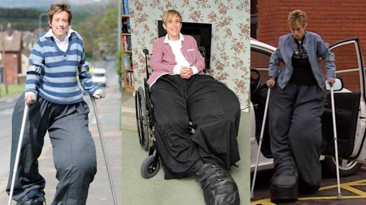 Mandy Sellars: Encouraging life story of the UK woman with 69kg legs ...