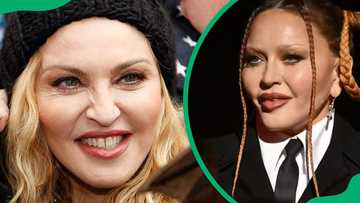 Madonna's plastic surgery: Timeline, experts' analysis, and photos ...
