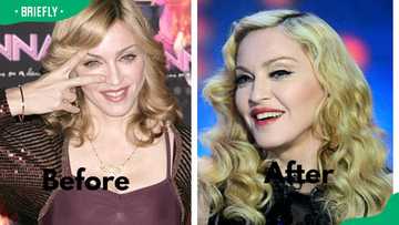 Madonna's plastic surgery: Timeline, experts' analysis, and photos ...