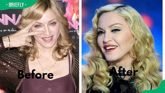 Madonna's plastic surgery: Timeline, experts' analysis, and photos ...