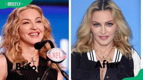 Madonna's plastic surgery: Timeline, experts' analysis, and photos ...