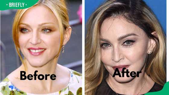 Madonna's plastic surgery: Timeline, experts' analysis, and photos ...