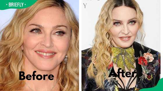 Madonna's plastic surgery: Timeline, experts' analysis, and photos ...