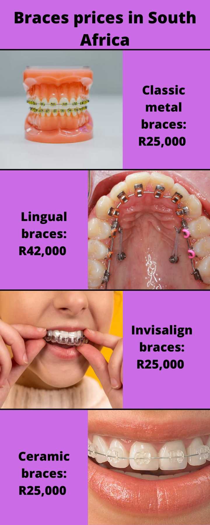 How much are braces in South Africa 2024? Braces price and infographic ...