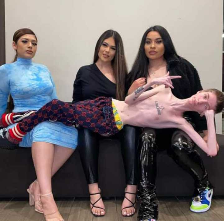 Who is Daddy Long Neck? Age, baby mama, disease, career, profile, worth ...