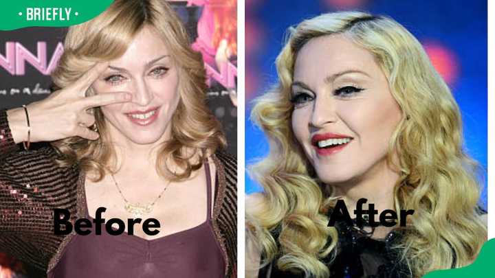 Madonna's plastic surgery: Timeline, experts' analysis, and photos ...