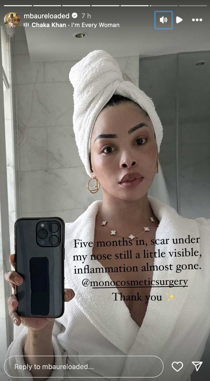 Khanyi Mbau Makes Official Face Reveal 5 Months Post-surgery With ...