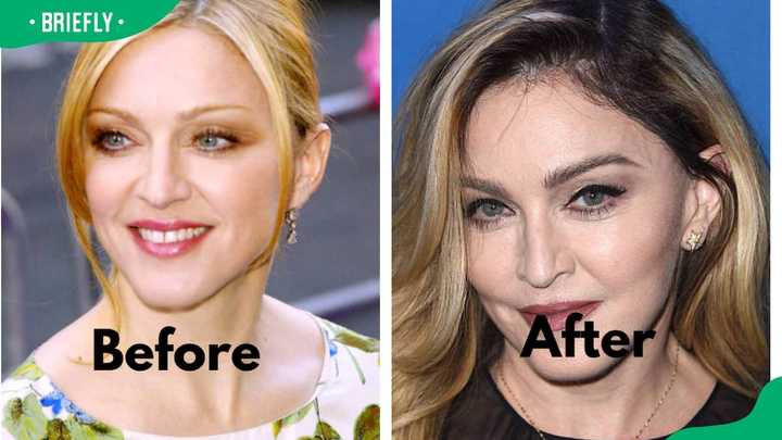 Madonna's plastic surgery: Timeline, experts' analysis, and photos ...